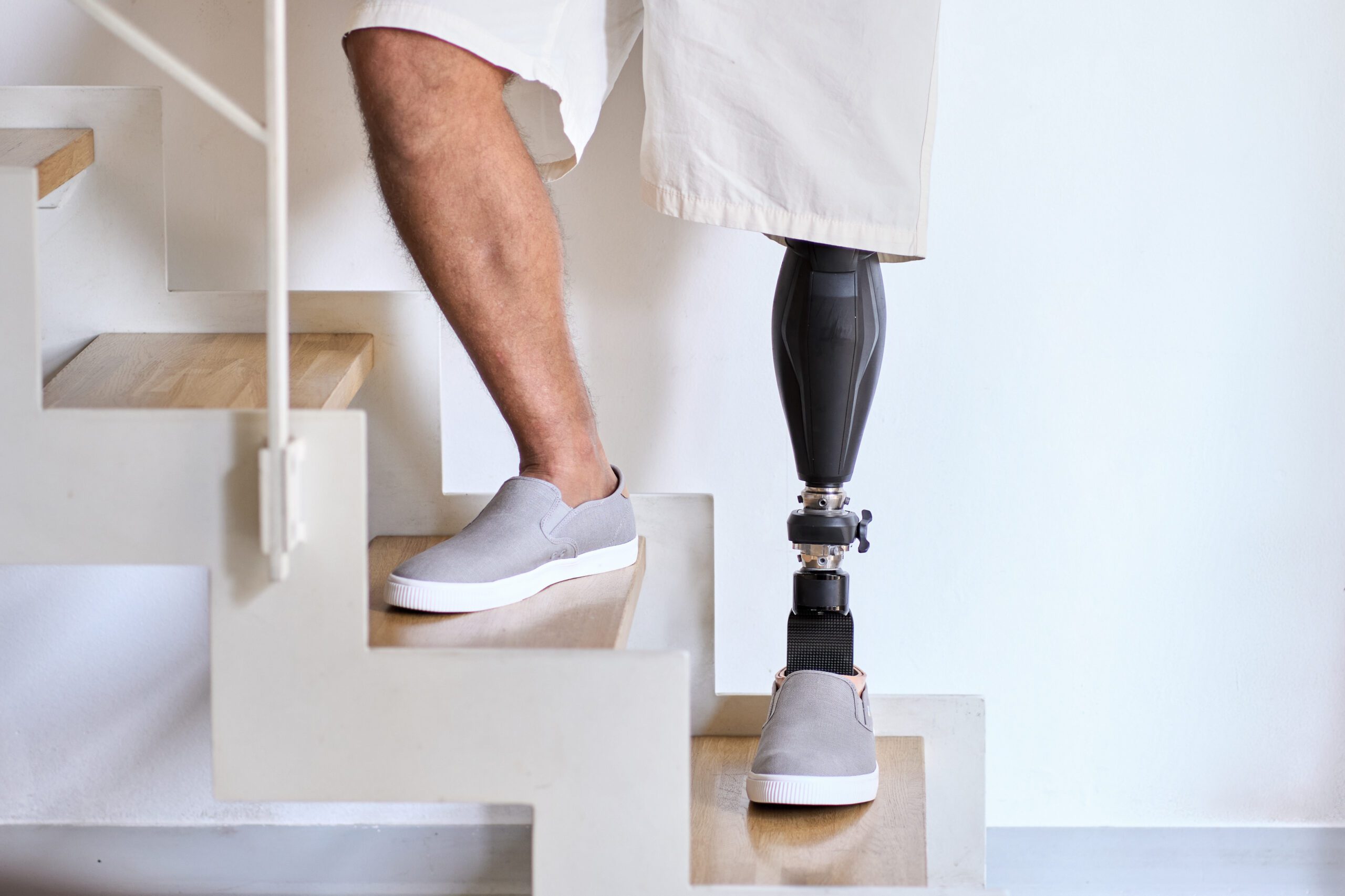 How Smart Prosthetic Technology Improves Safety, Comfort, and Confidence